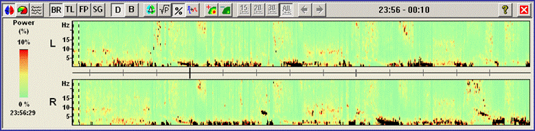 BESA Research Spectral Analysis - BESA® Wiki