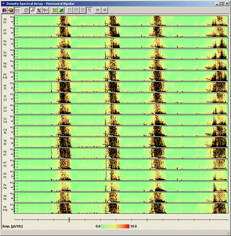 File:Spectral (49).gif - BESA® Wiki