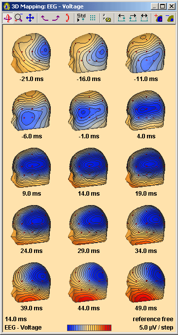 BESA Research Mapping - BESA® Wiki