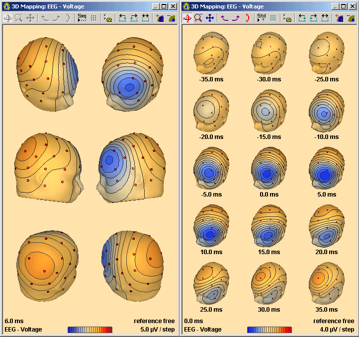 BESA Research Mapping - BESA® Wiki
