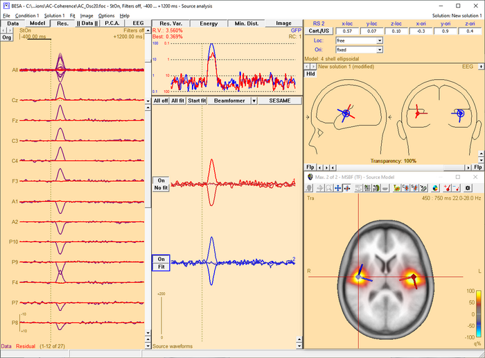 Loreta Source Localization Flash Sales | emergencydentistry.com